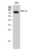 Abcepta AP71950 PKC polyclonal antibody - 试剂仪器耗材